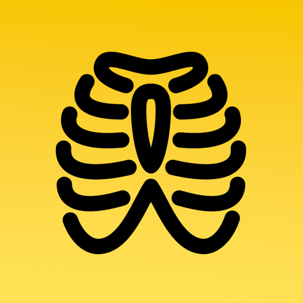 Chest X-ray (CXR) Made Easy | Master Radiology Interpretation