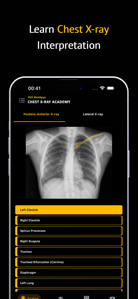 Chest X-ray (CXR) Made Easy | Master Radiology Interpretation
