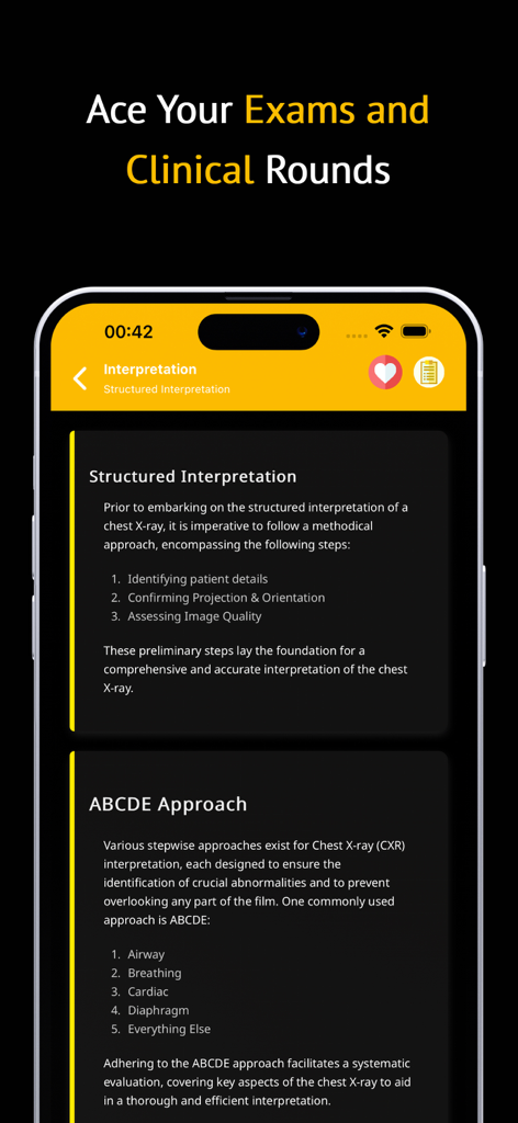 Chest X-ray (CXR) Made Easy | Master Radiology Interpretation