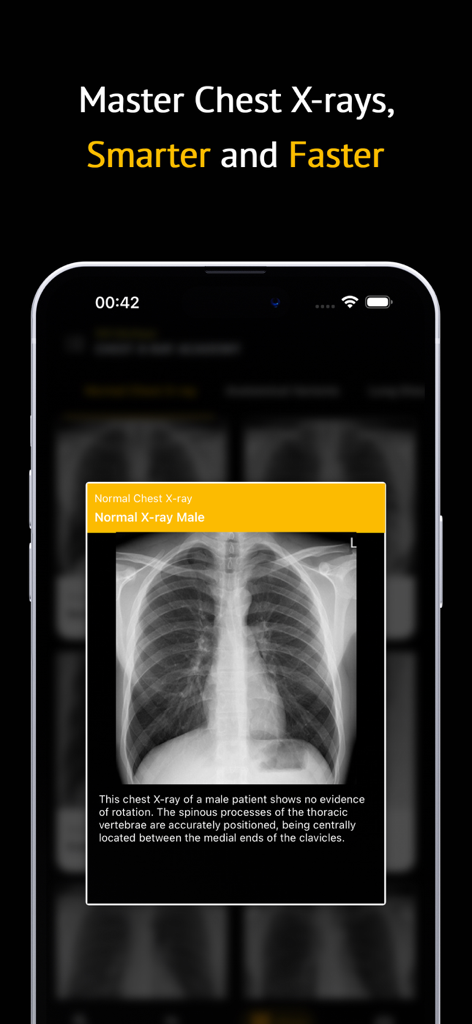 Chest X-ray (CXR) Made Easy | Master Radiology Interpretation